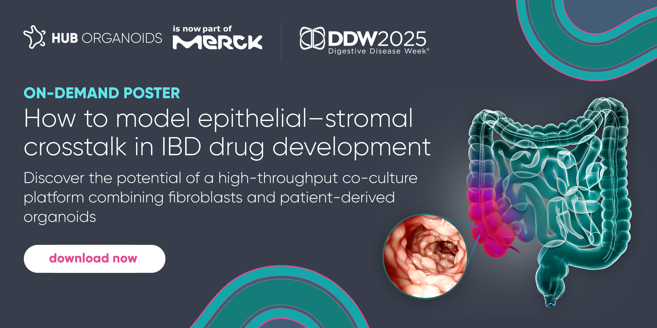 How to model epithelial–stromal crosstalk in IBD drug development