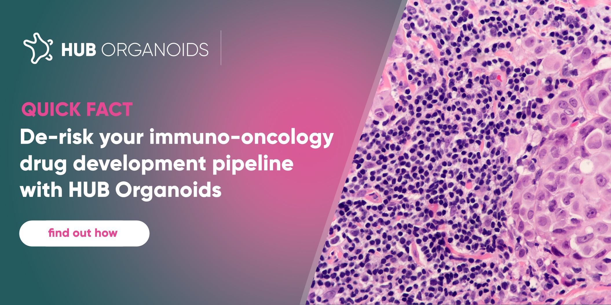 De-risk your immuno-oncology drug development with HUB Organoids